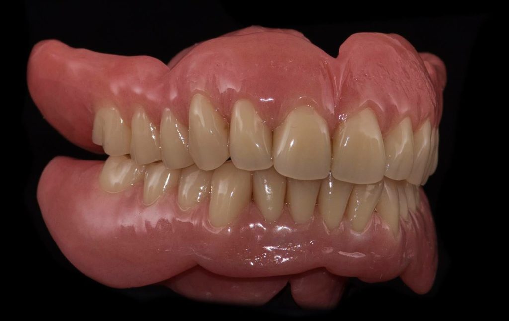 ODONTOIATRIA PROTESICA - Studio Dentistico Capuzzello